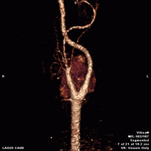 Cardiac Echography – Medical GIF